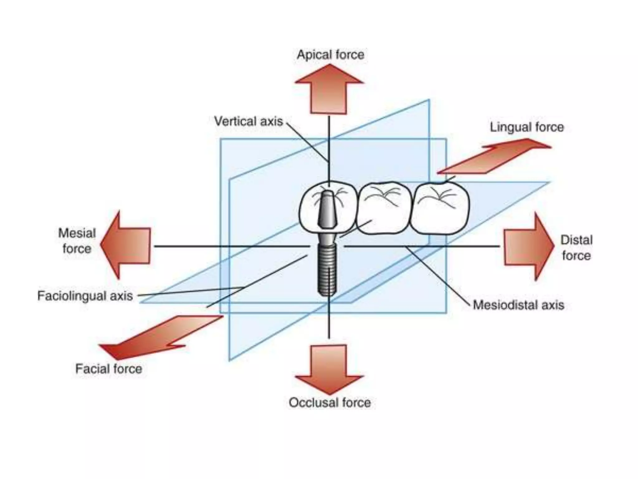 Biomechanics dental implants | PPTX