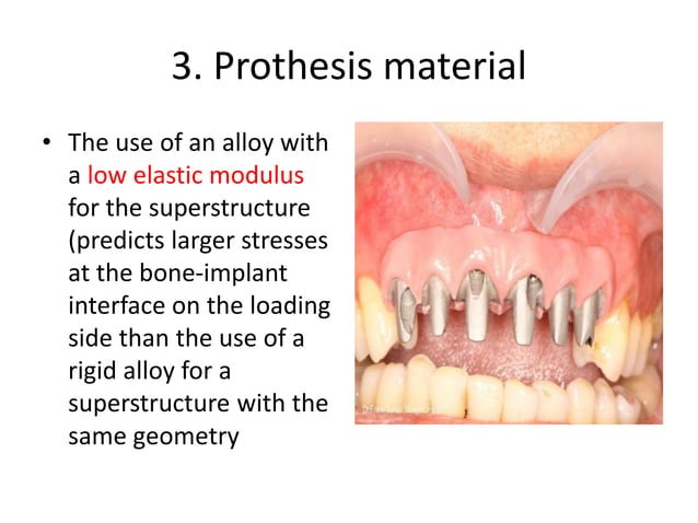 Biomechanics dental implants | PPTX