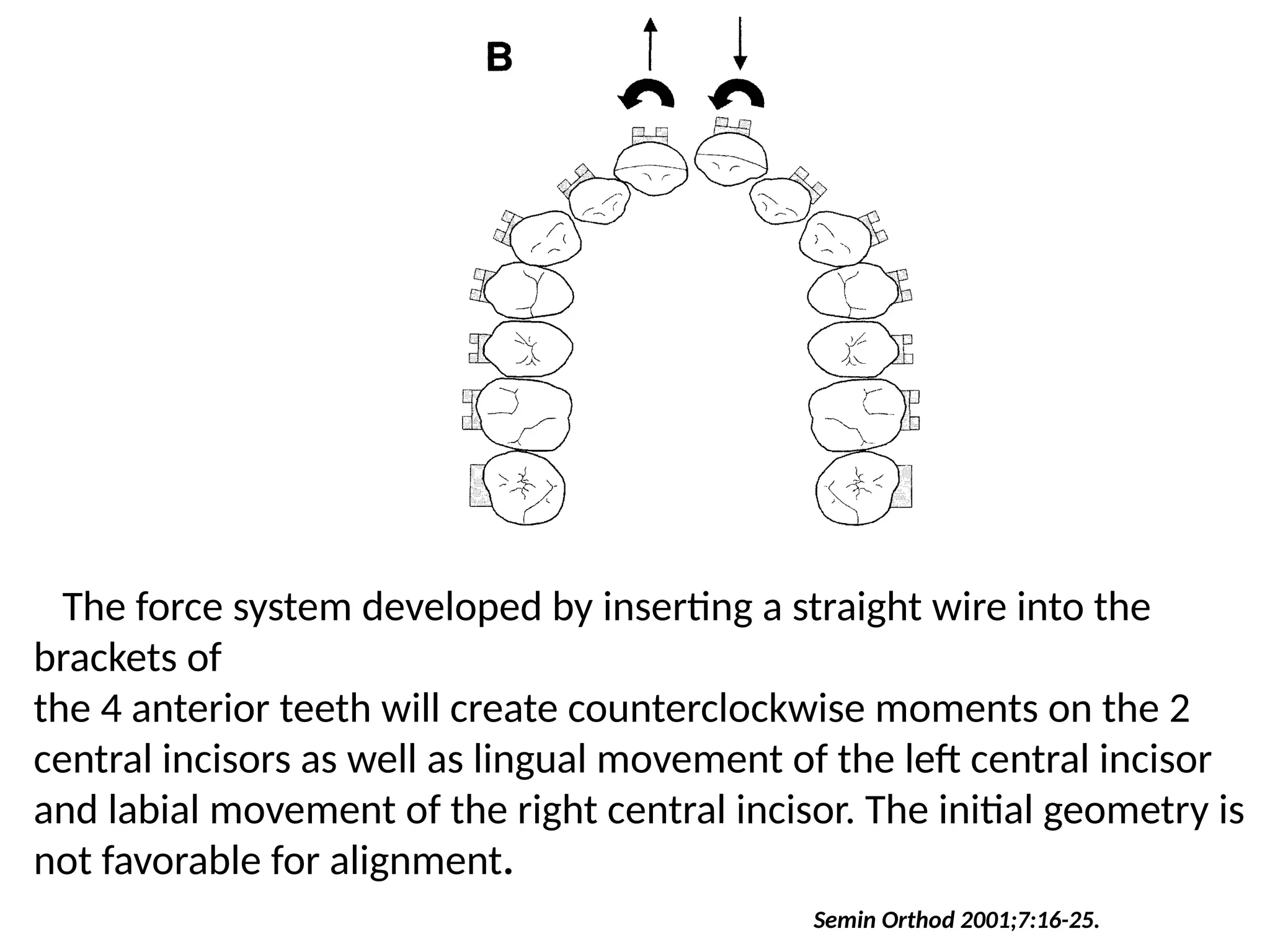 BIOMECHANICS IN ORTHONTICS , DENTISTRY.. | PPTX