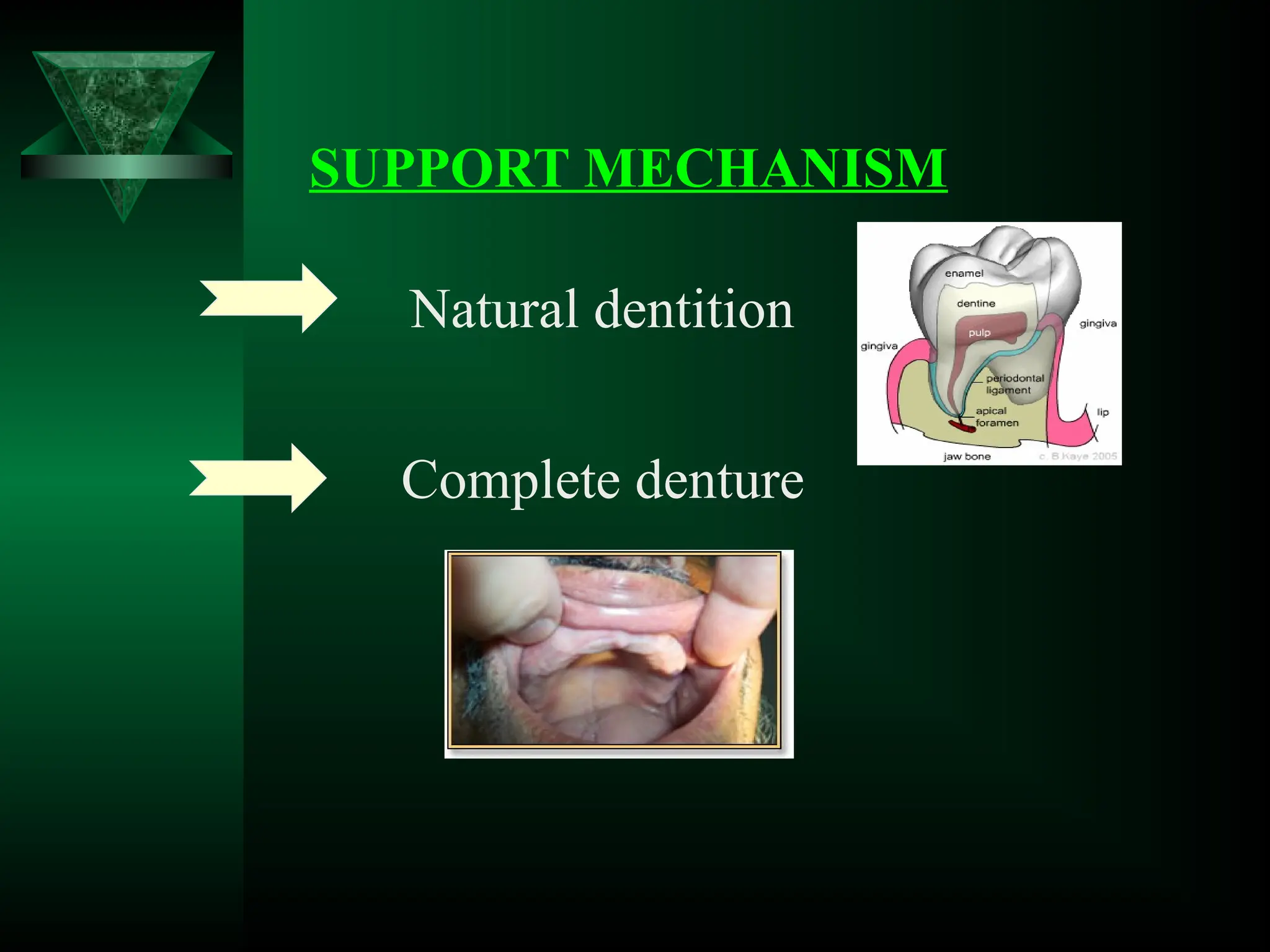 BIOMECHANICS OF EDENTULOUS STATE IN PROSTHODONTICS | PPTX | Oral care ...
