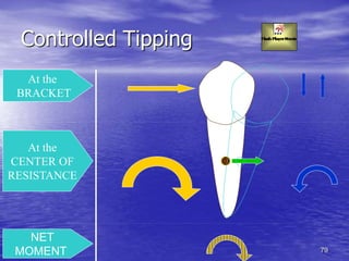BIOMECHANICS IN CLINICAL ORTHO - c.b patil.ppt