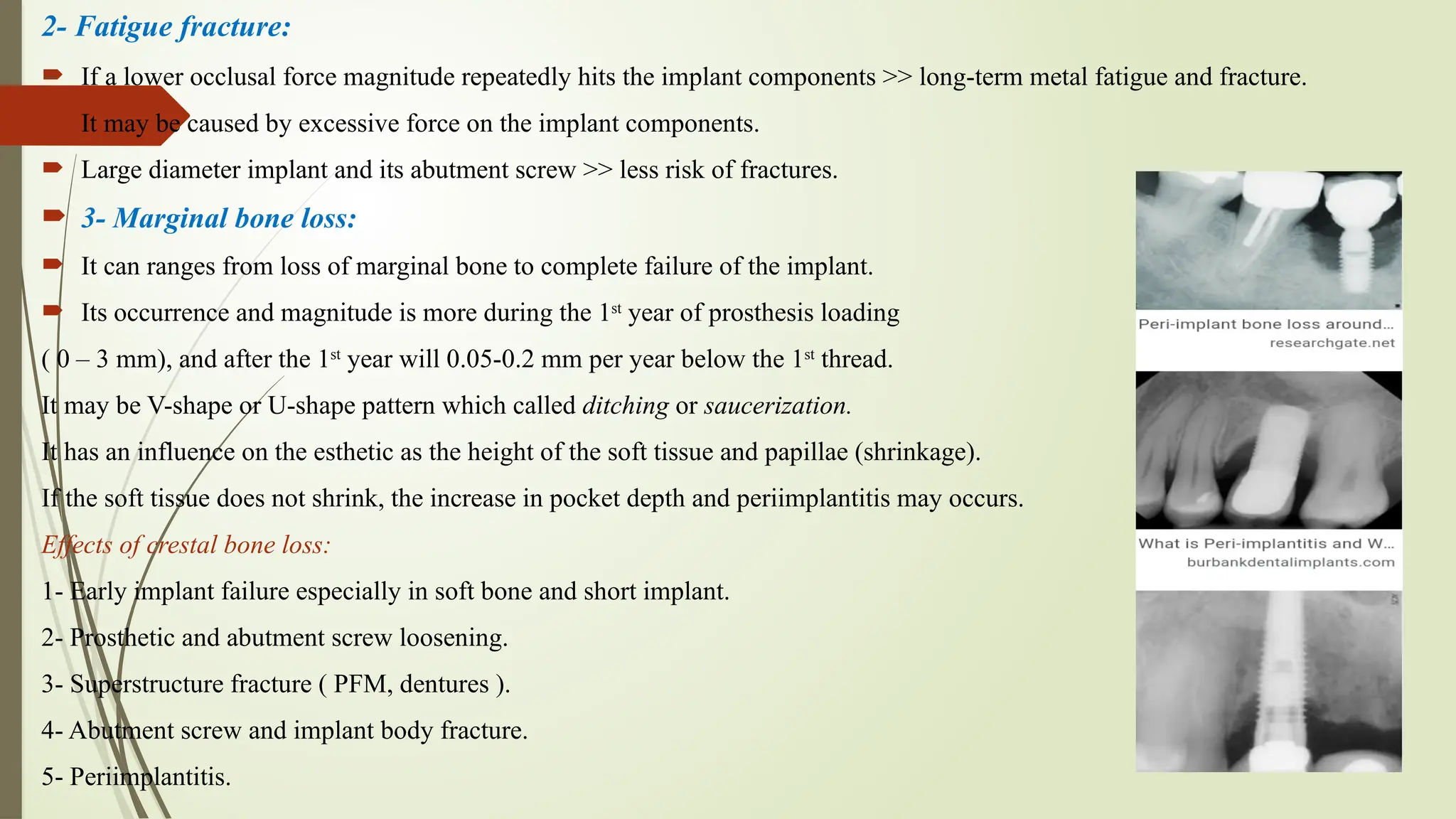 Biomechanics in dental implants course.pptx