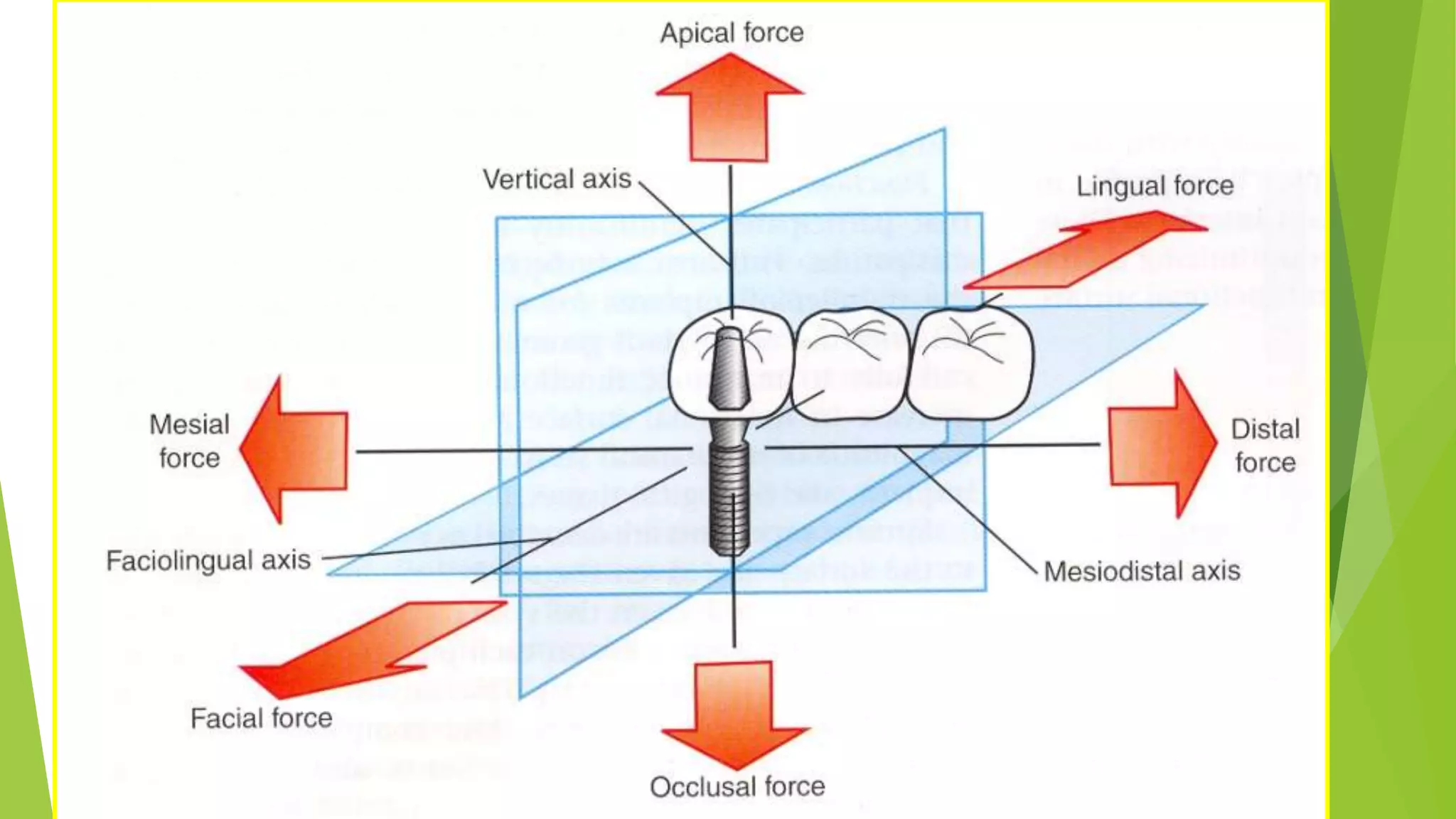 Biomechanics in implantology | PPTX