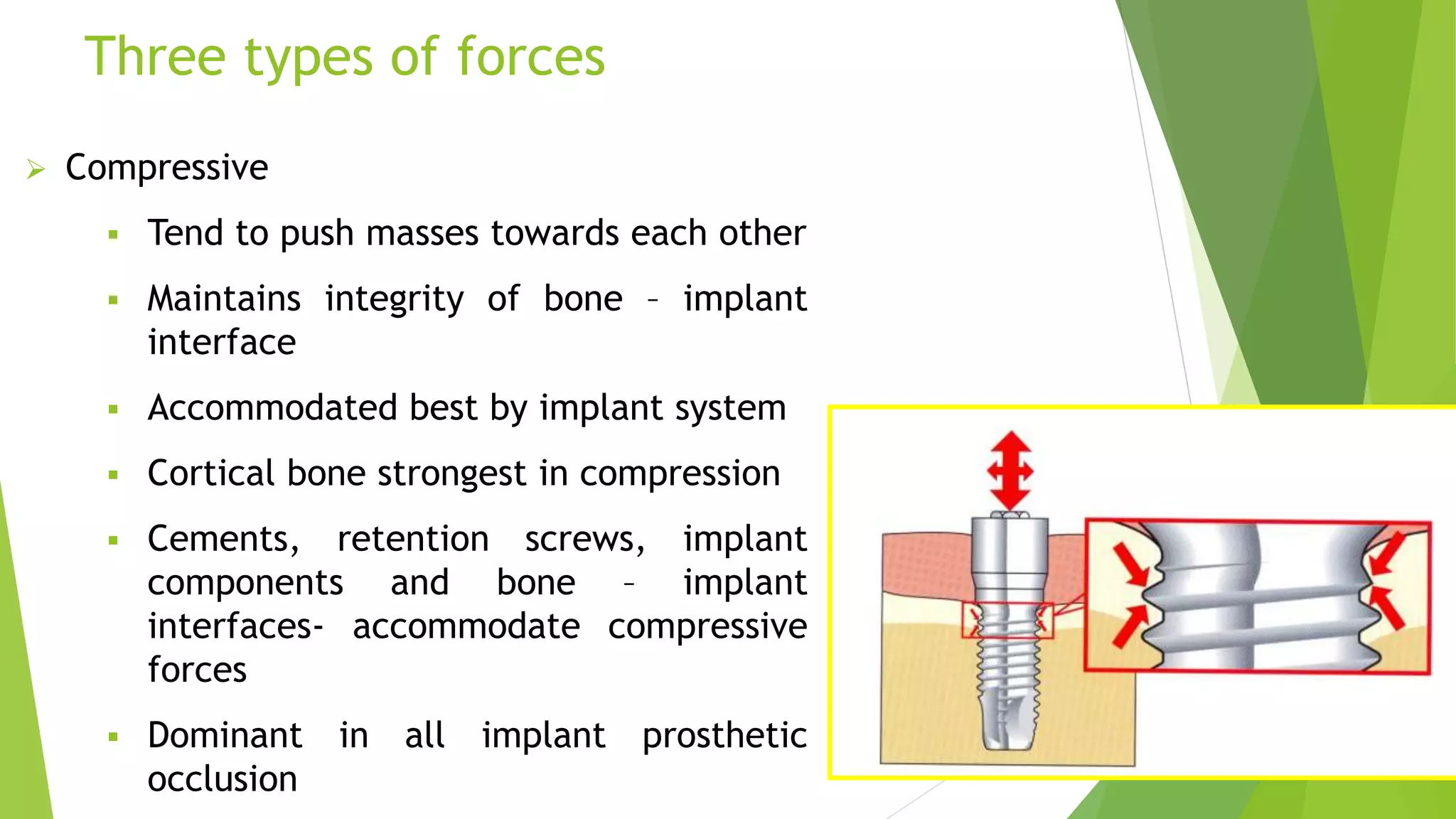 Biomechanics in implantology | PPTX