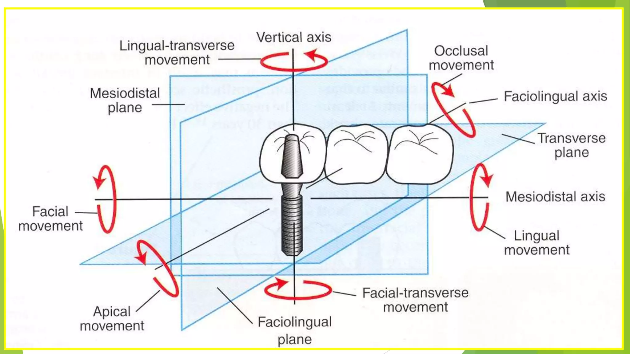 Biomechanics in implantology | PPTX