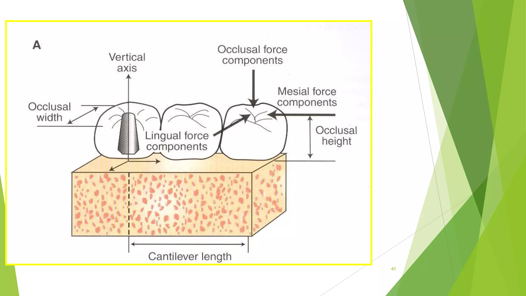 Biomechanics in implantology | PPTX