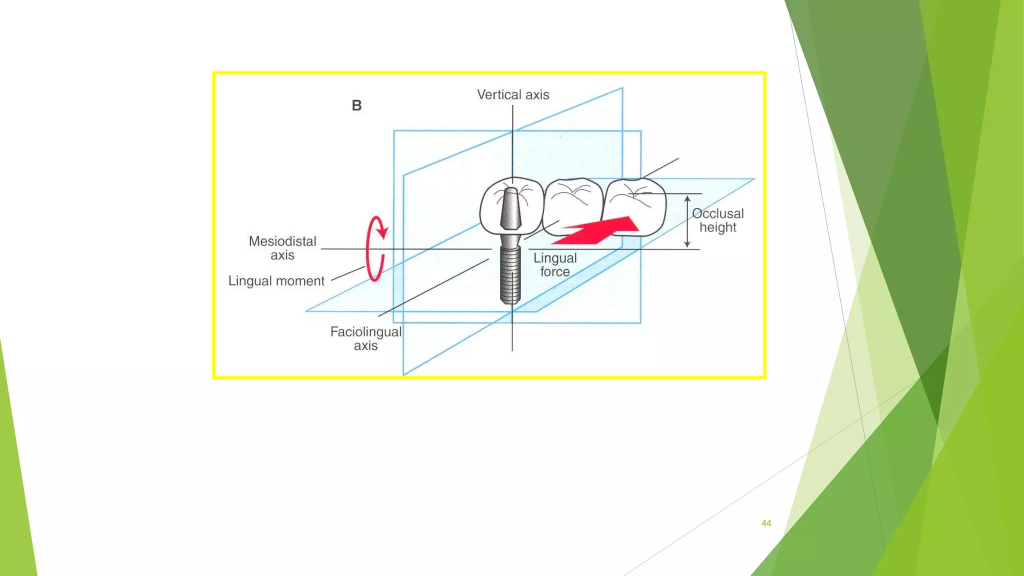 Biomechanics in implantology | PPTX