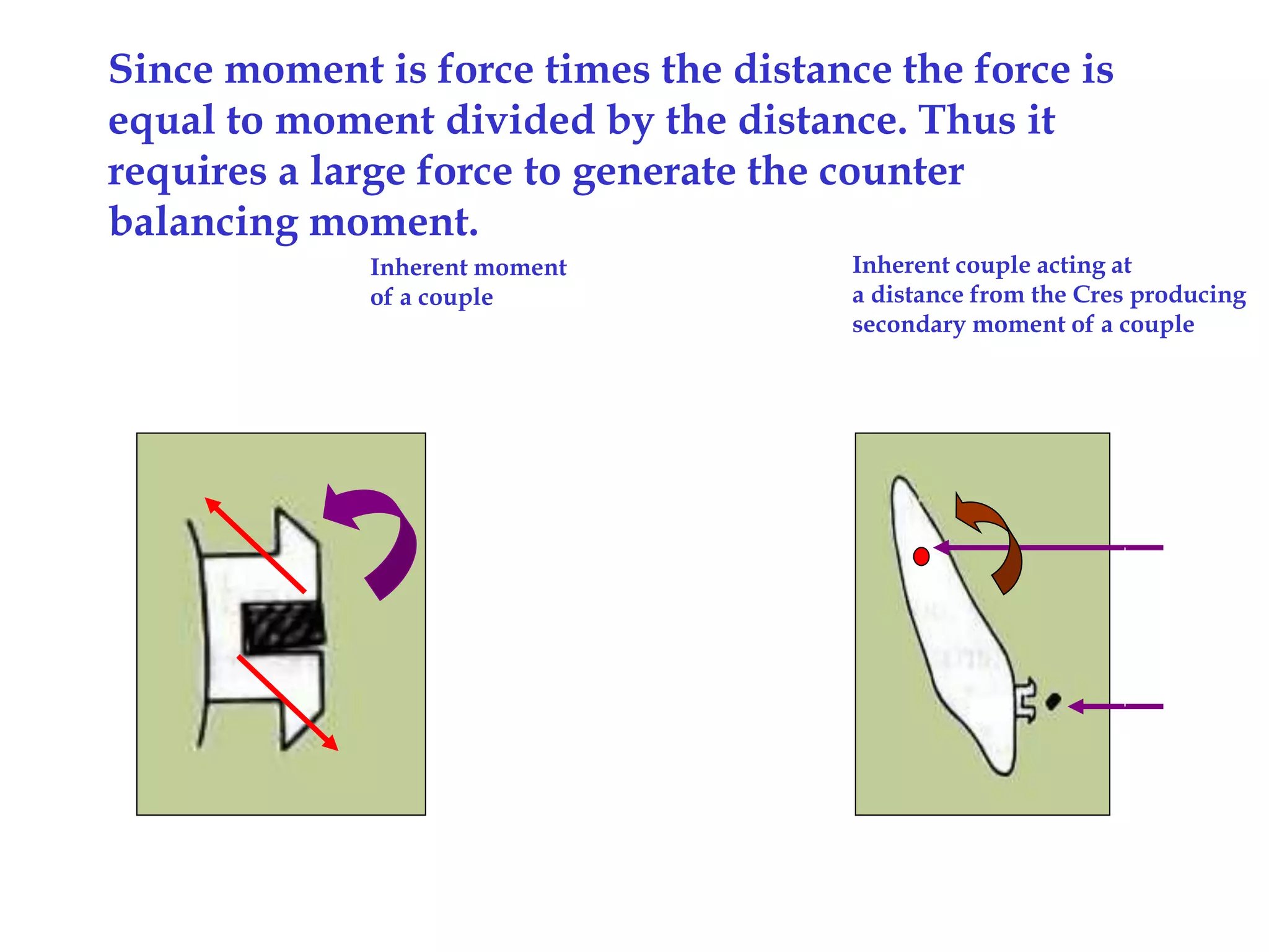 Biomechanics in Orthodontics | PPT