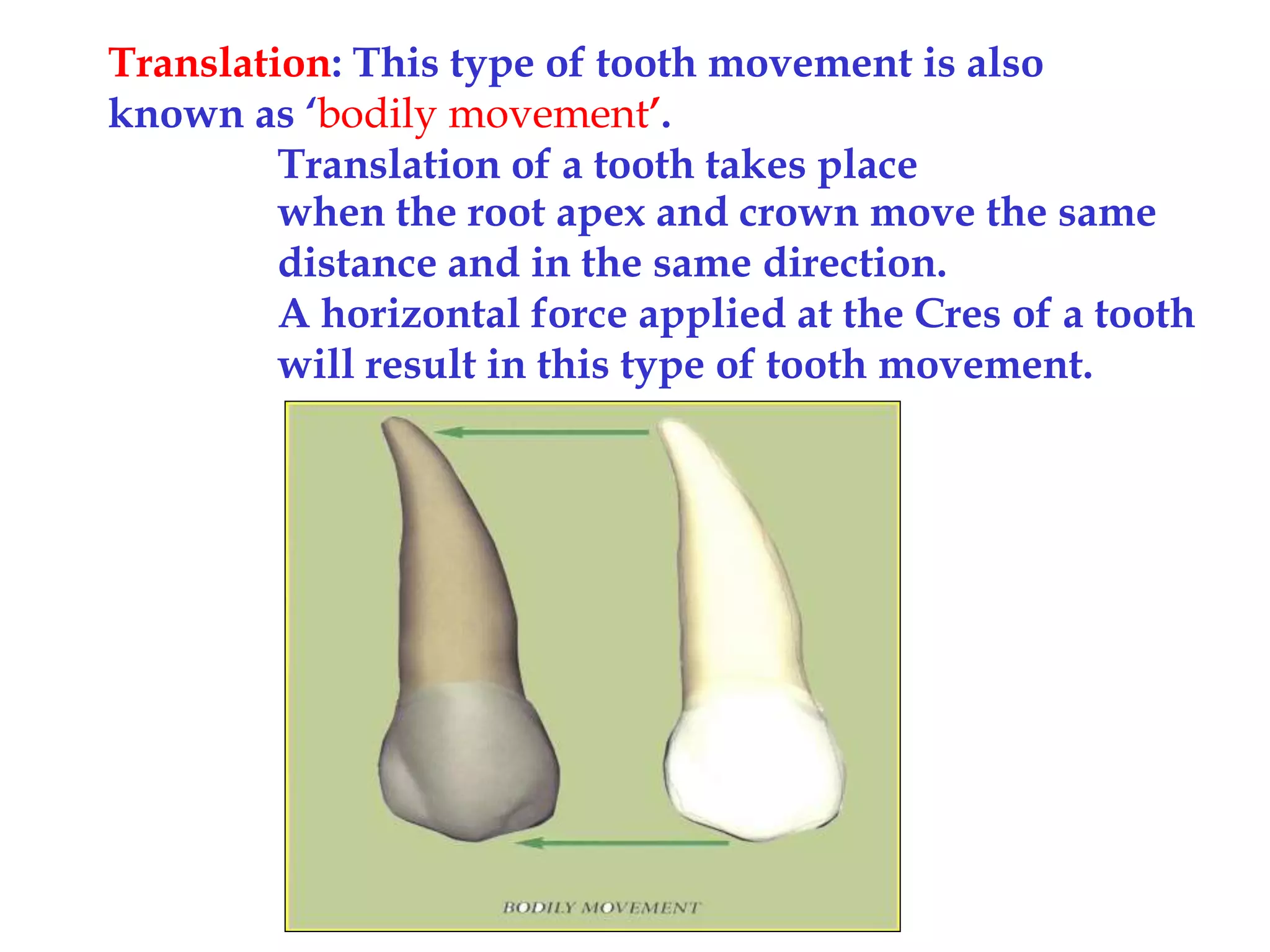 Biomechanics in Orthodontics | PPT