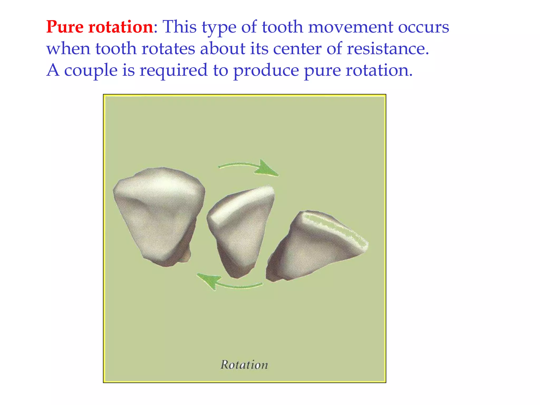 Biomechanics in Orthodontics | PPT