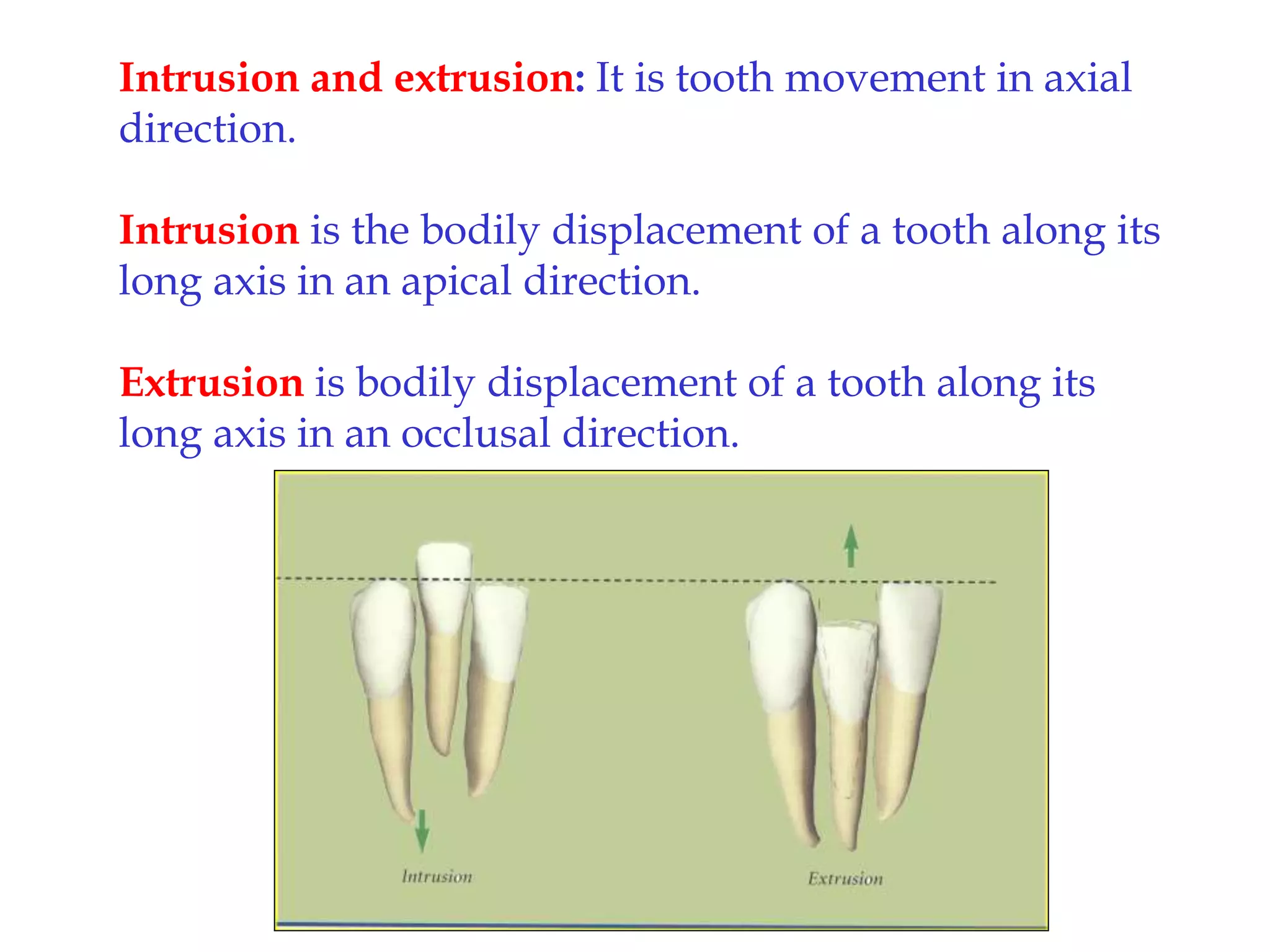Biomechanics in Orthodontics | PPT