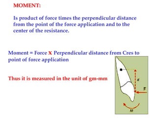 Biomechanics in Orthodontics | PPT