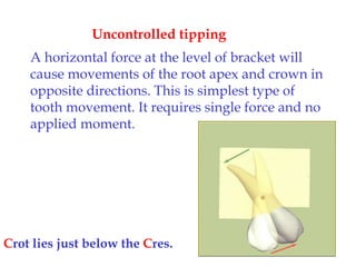 Biomechanics in Orthodontics | PPT