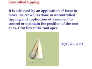 Biomechanics in Orthodontics | PPT