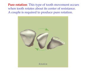 Biomechanics in Orthodontics | PPT