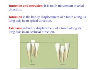 Biomechanics in Orthodontics | PPT