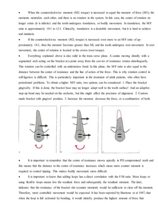 Biomechanics in orthodontics by almuzian | DOCX