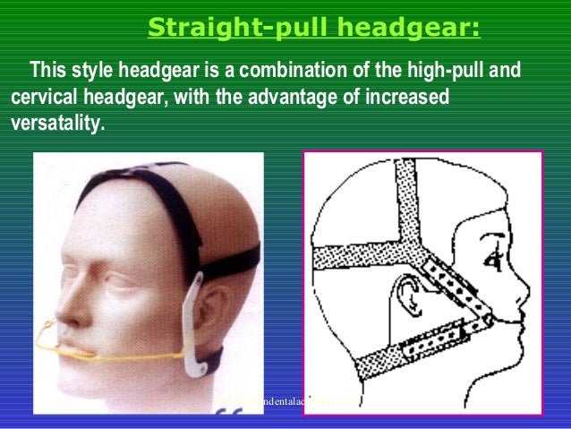 Biomechanics in orthopedics