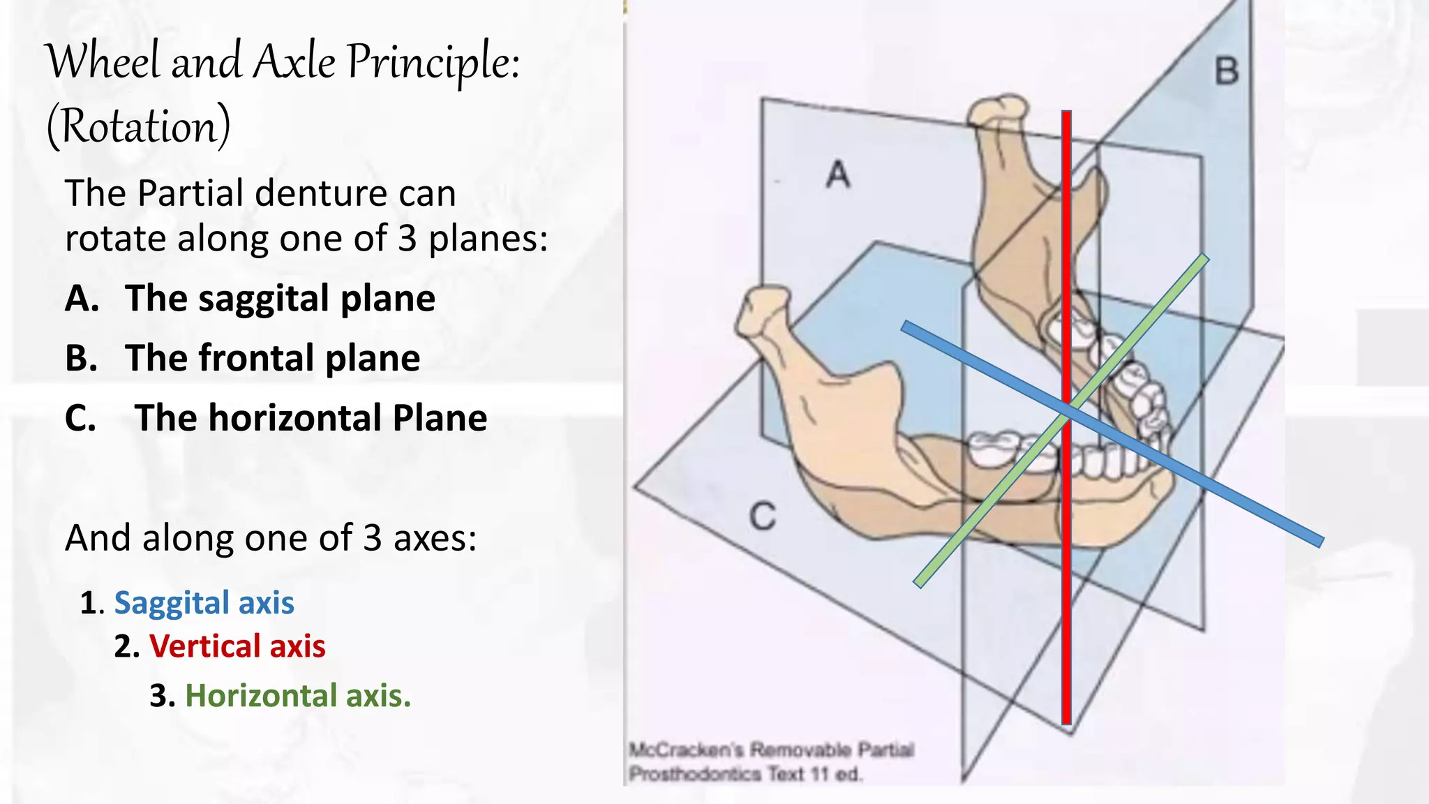 Biomechanics in removable partial denture | PPTX