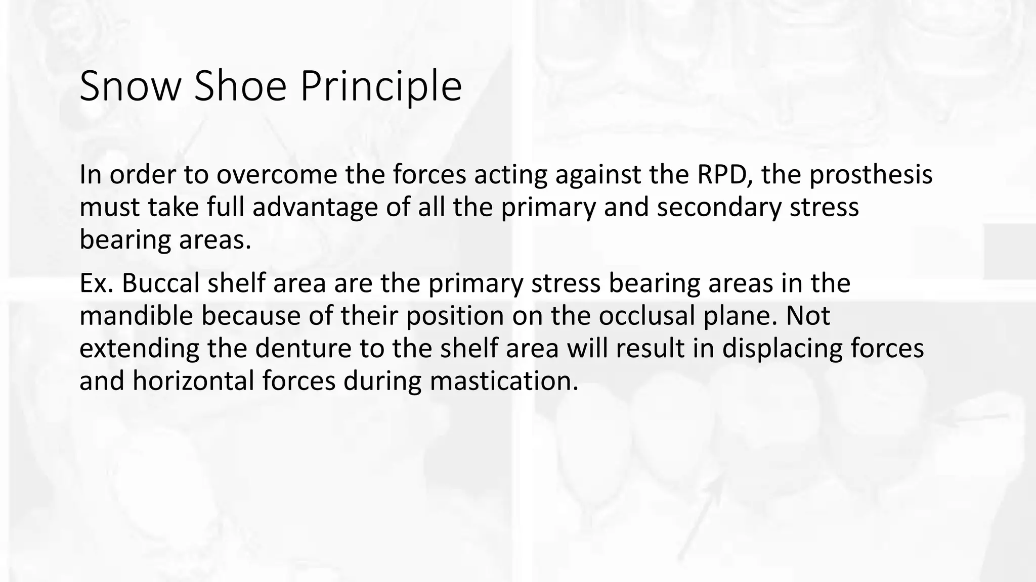 Biomechanics in removable partial denture | PPTX