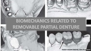 Biomechanics in removable partial denture | PPTX