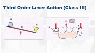 Biomechanics in removable partial denture | PPTX
