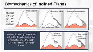 Biomechanics in removable partial denture | PPTX