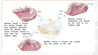 Biomechanics in removable partial denture | PPTX