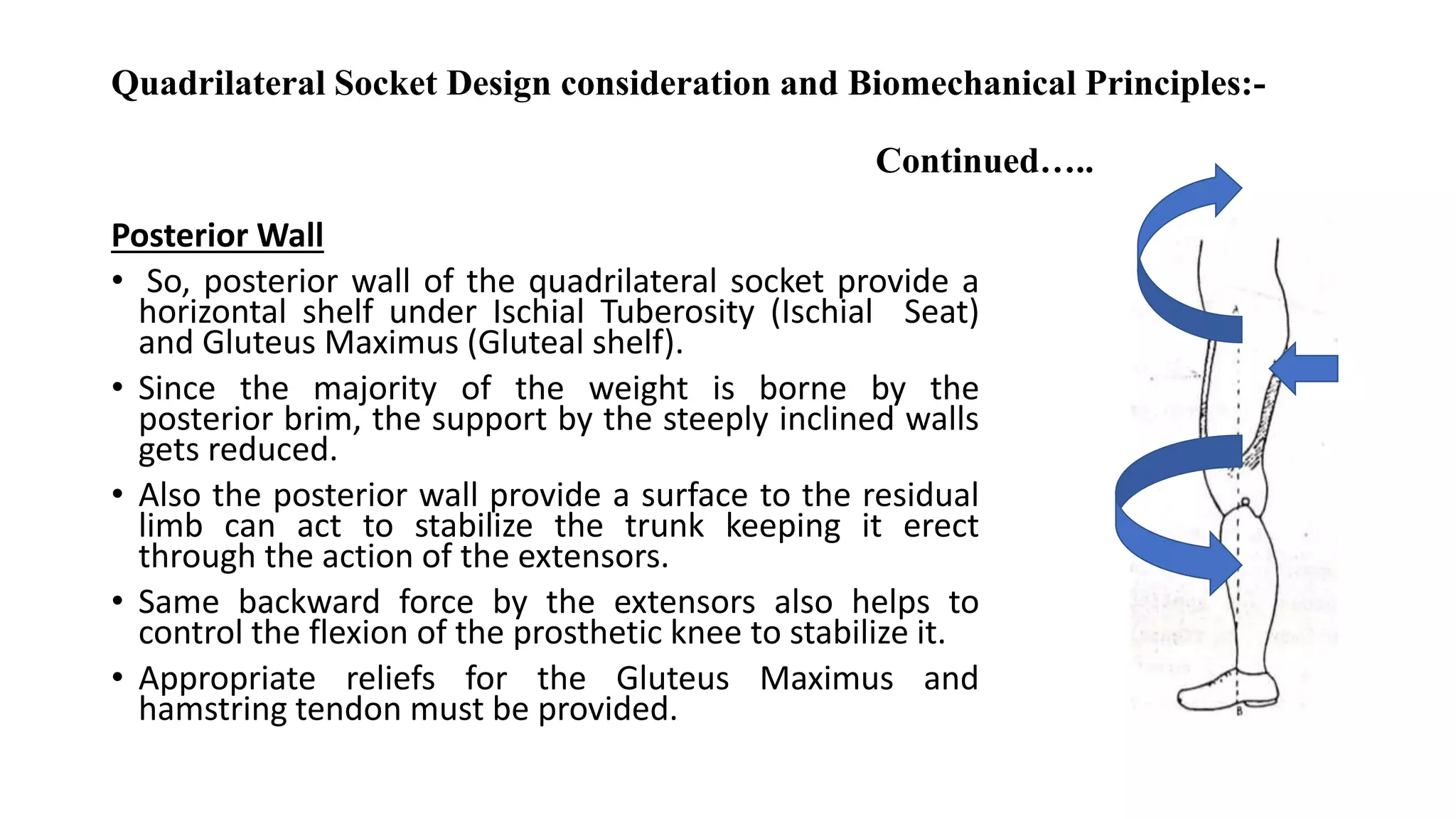 Biomechanics of Quadrilateral Socket | PPTX