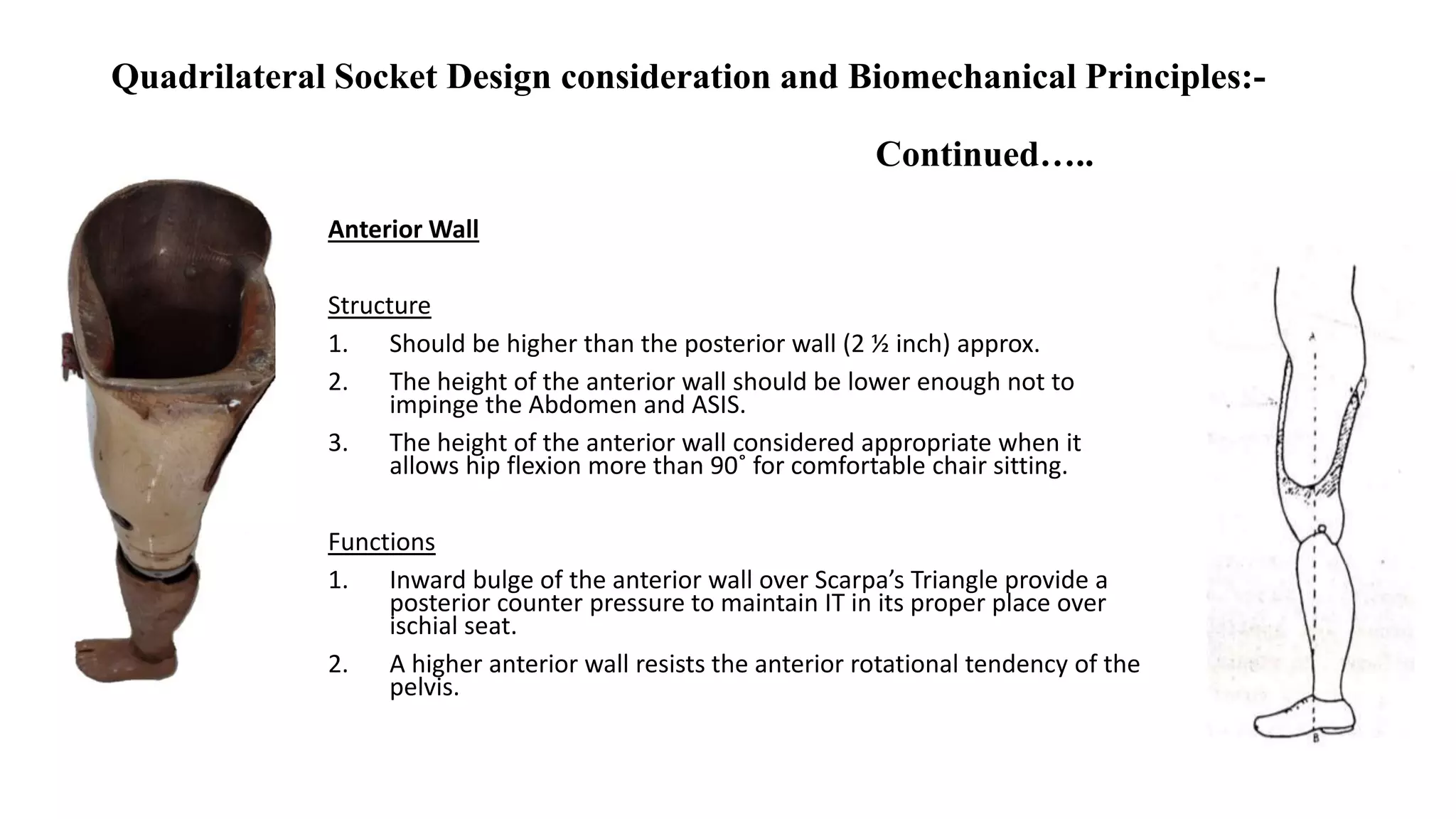 Biomechanics of Quadrilateral Socket | PPTX