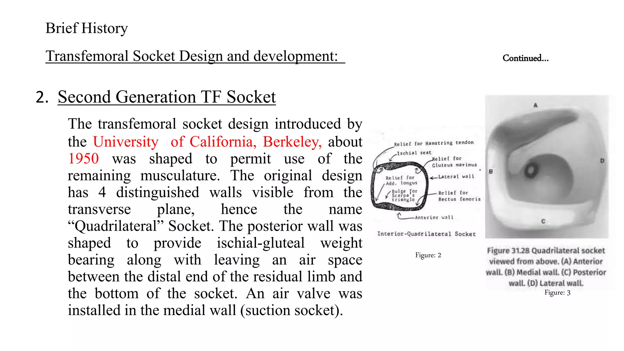 Biomechanics of Quadrilateral Socket | PPTX