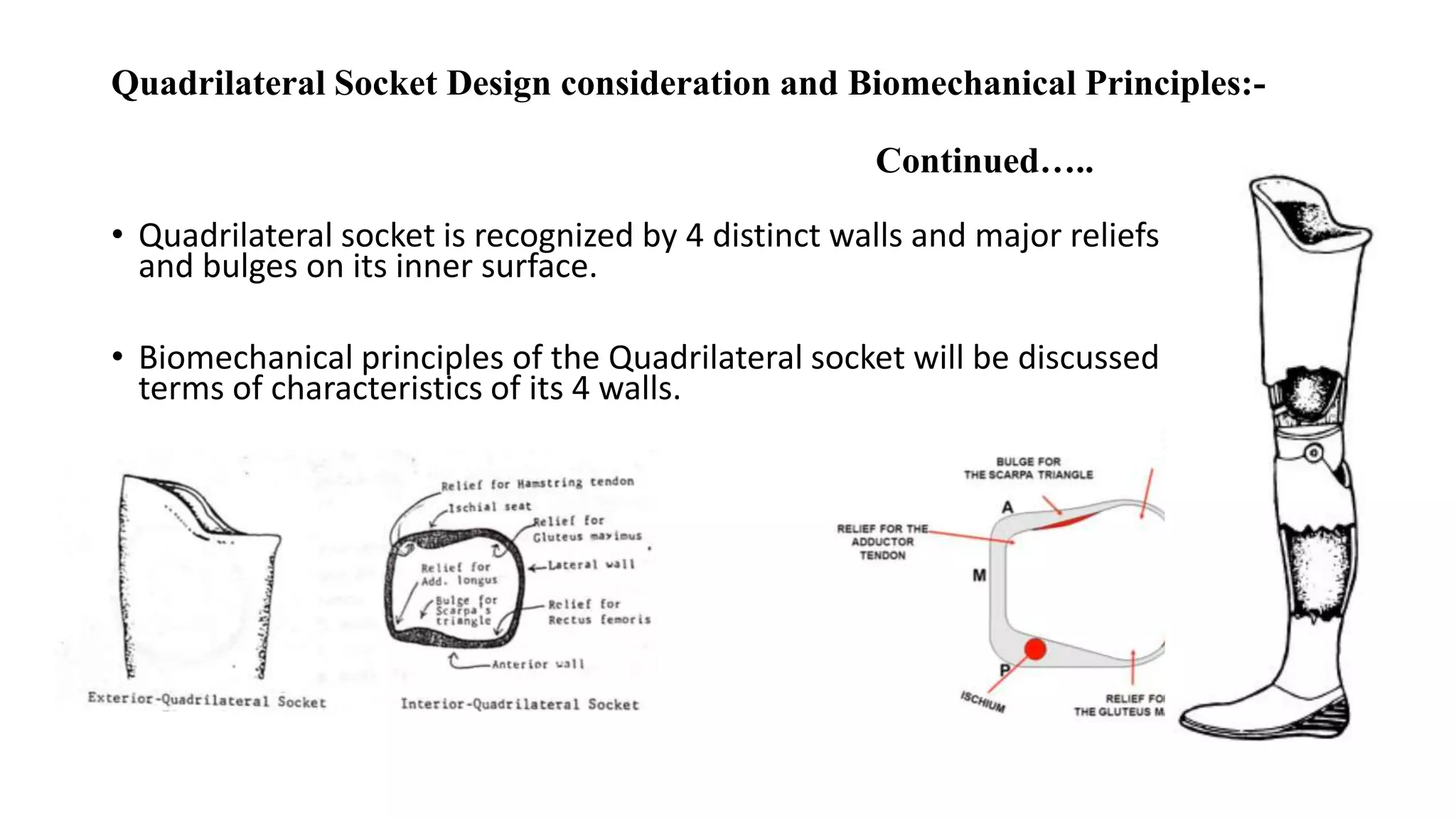 Biomechanics of Quadrilateral Socket | PPTX
