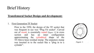 Biomechanics of Quadrilateral Socket | PPTX