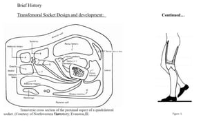 Biomechanics of Quadrilateral Socket | PPTX