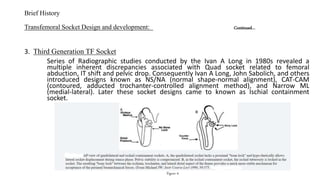 Biomechanics of Quadrilateral Socket | PPTX