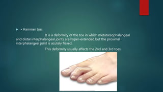 Biomechanics of ankle and foot | PPTX
