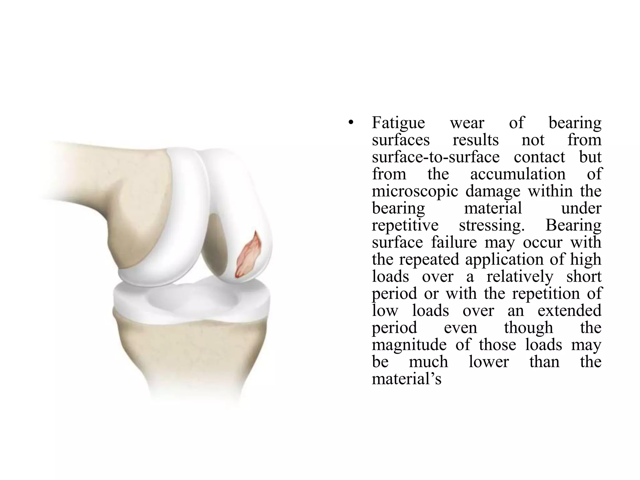 Biomechanics of articular cartilage | PPTX