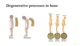 Biomechanics of bones PDF | PDF
