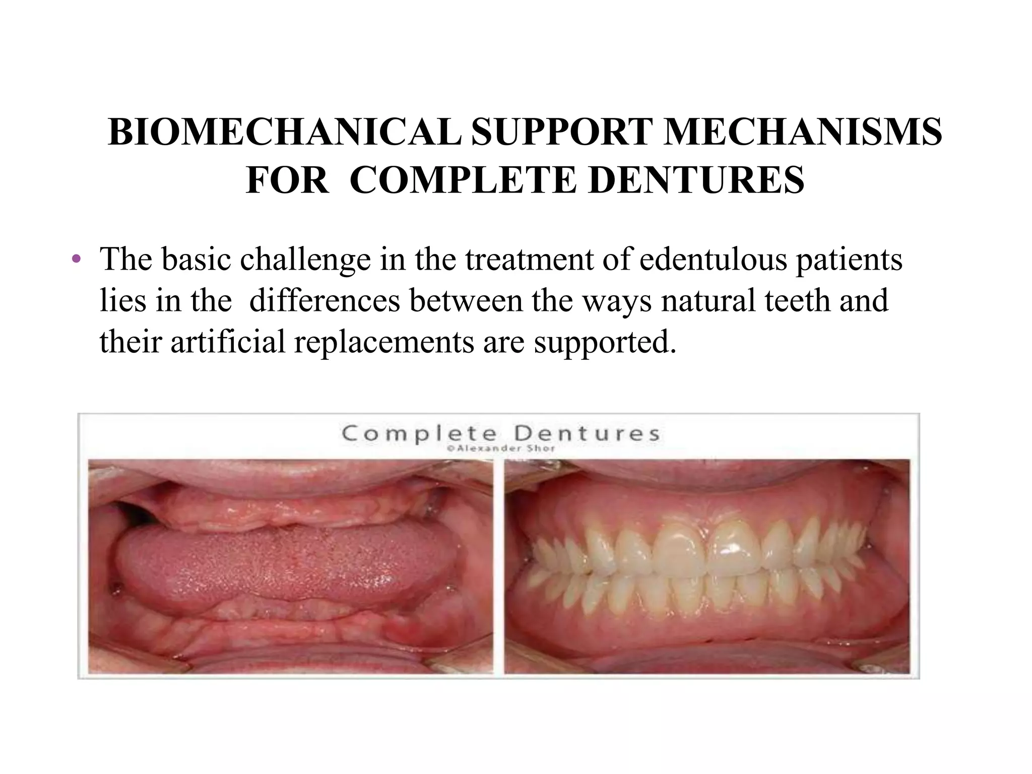 Biomechanics of Edentulous State | PPTX