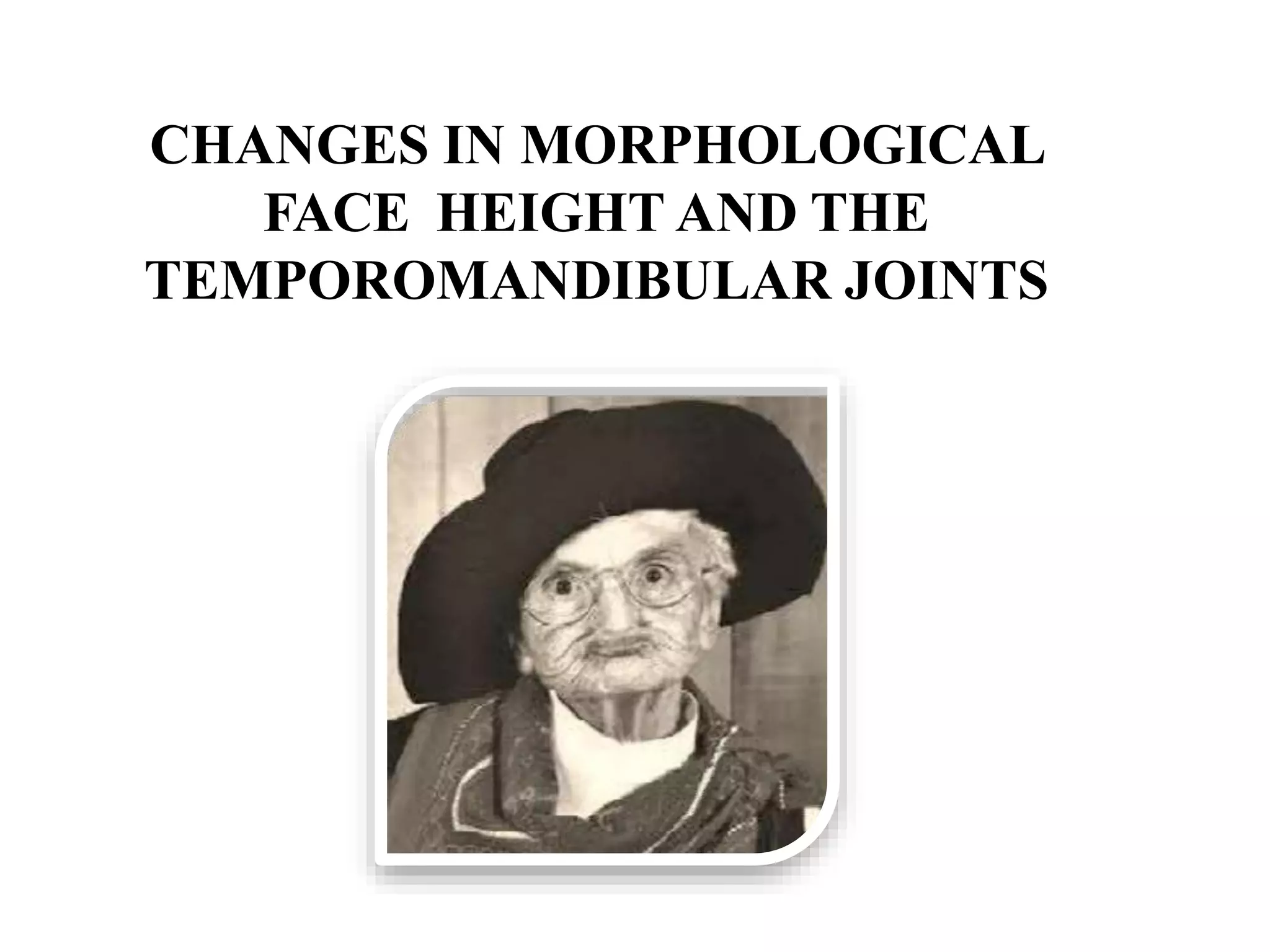 Biomechanics of Edentulous State | PPTX