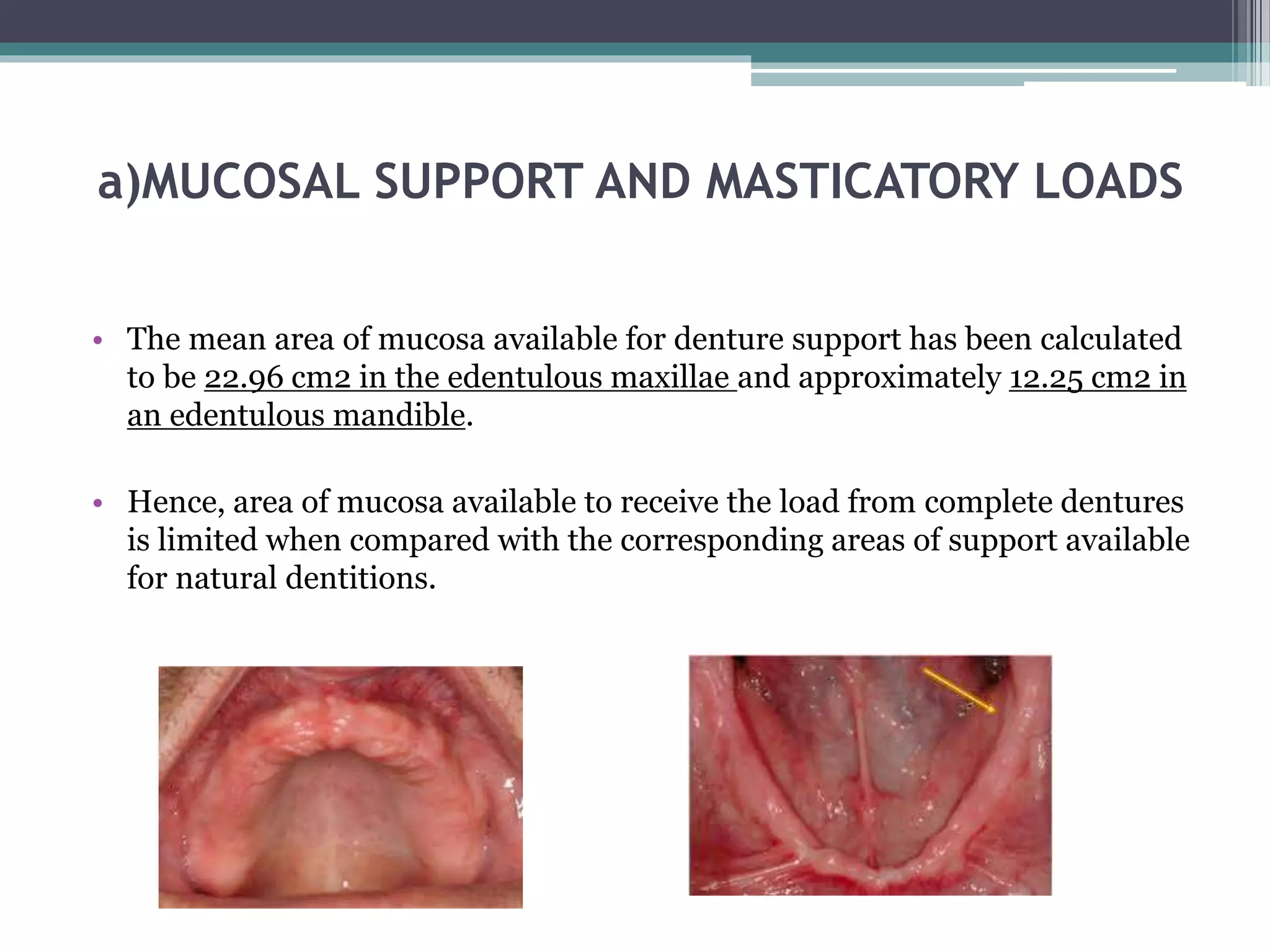 Biomechanics of edentulous state | PPTX