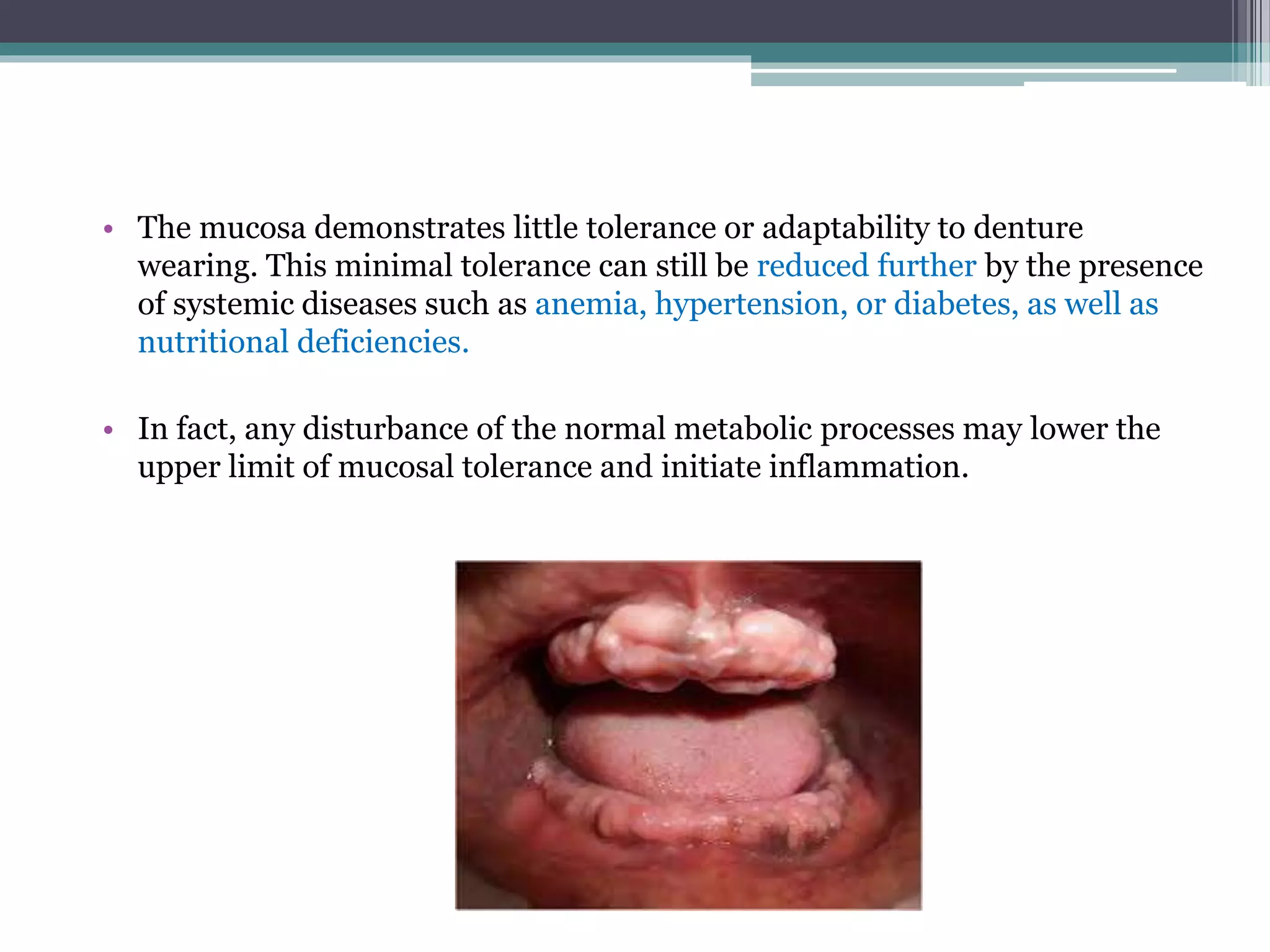 Biomechanics of edentulous state | PPTX