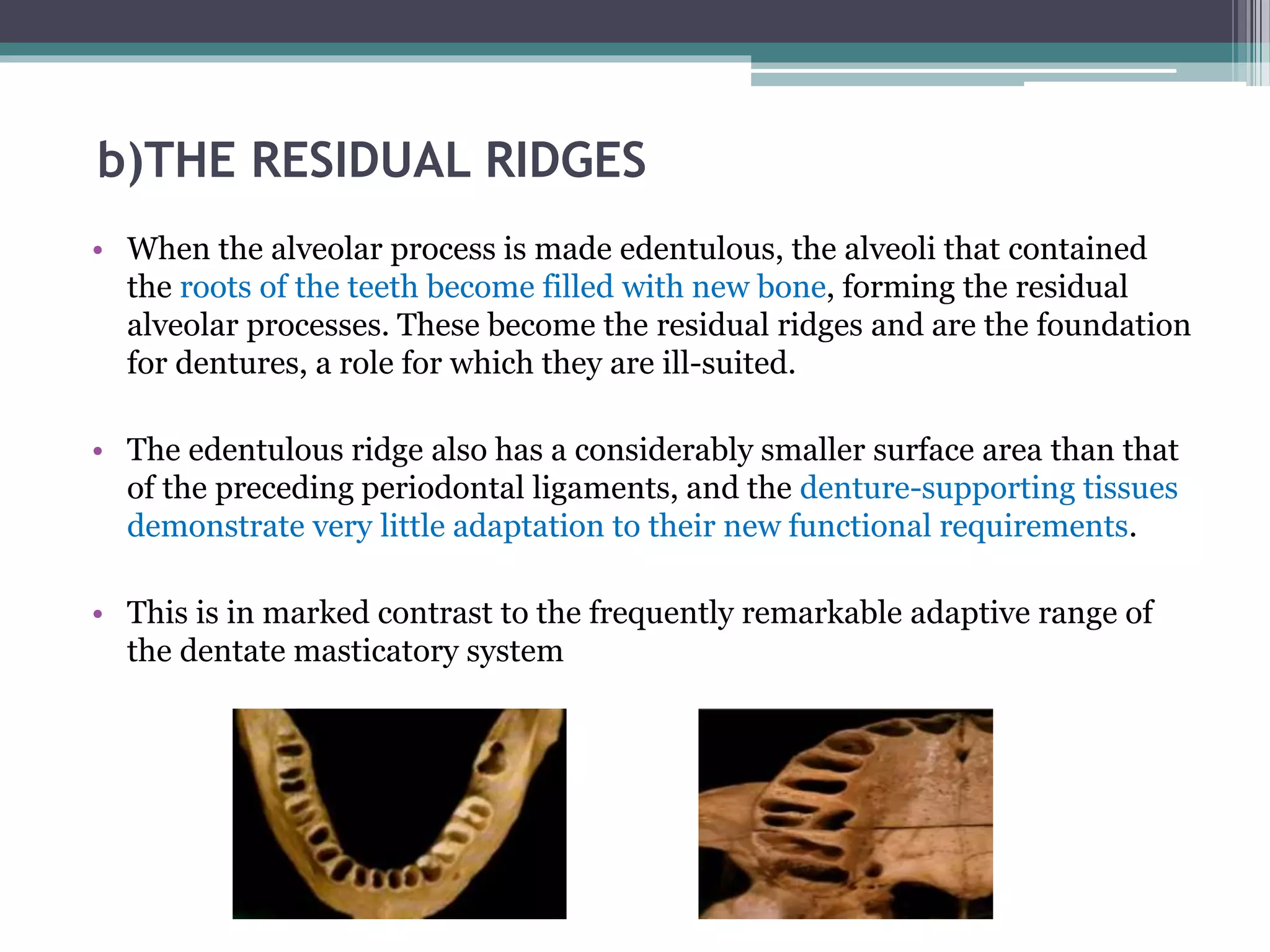 Biomechanics of edentulous state | PPTX