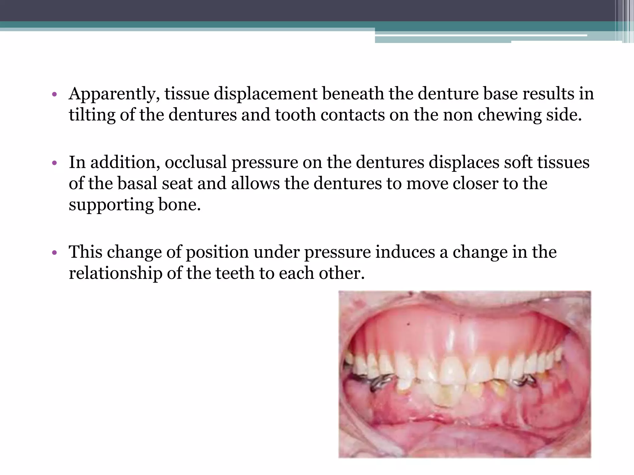 Biomechanics of edentulous state | PPTX