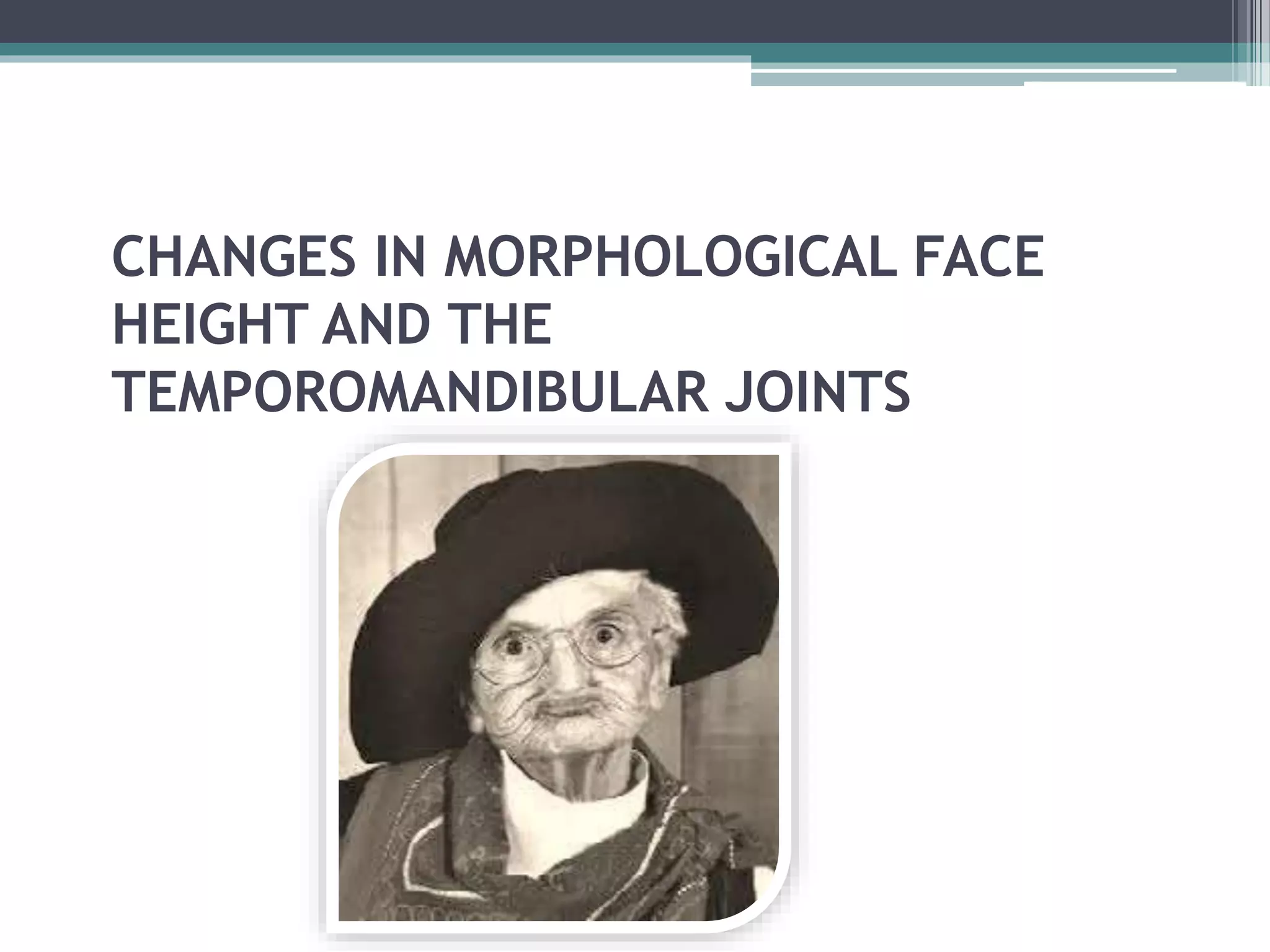 Biomechanics of edentulous state | PPTX