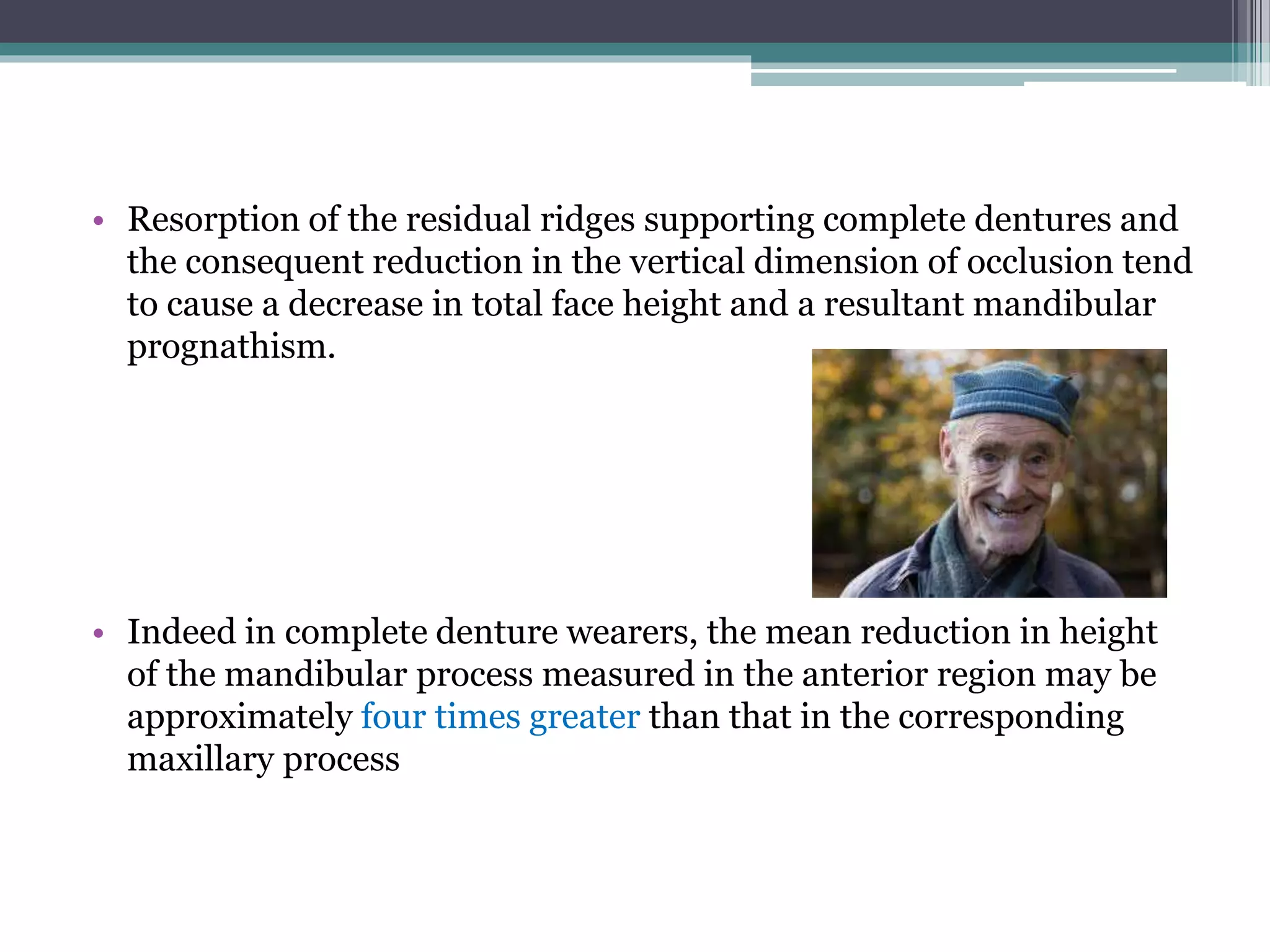 Biomechanics of edentulous state | PPTX