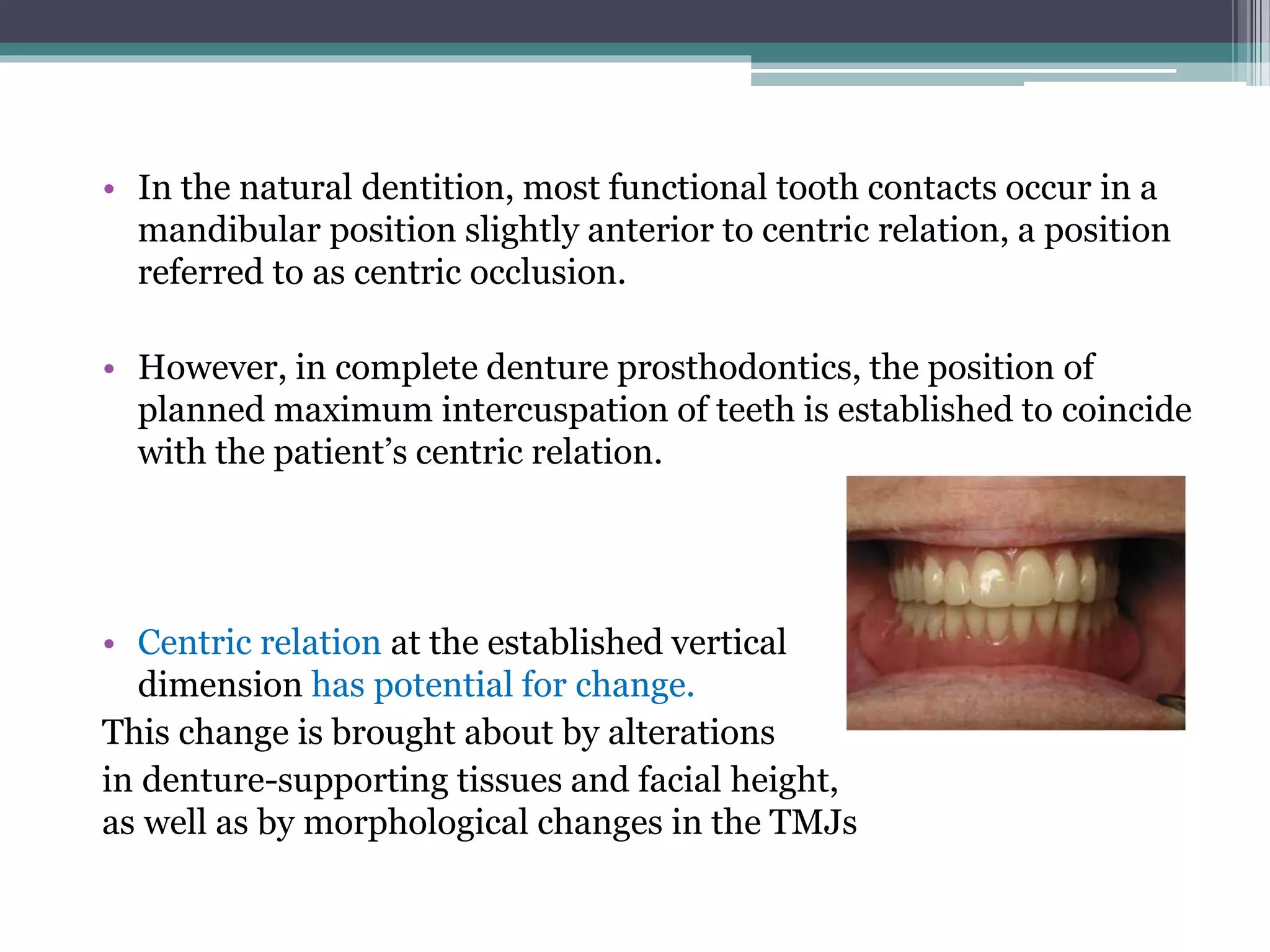 Biomechanics of edentulous state | PPTX