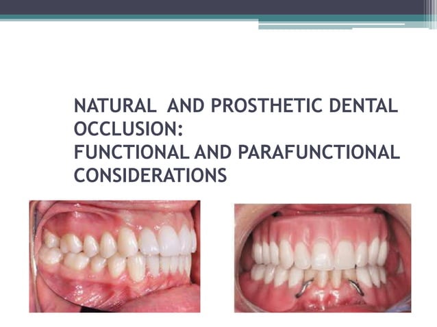 Biomechanics of edentulous state | PPTX