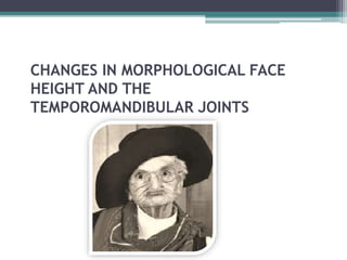 Biomechanics of edentulous state | PPTX