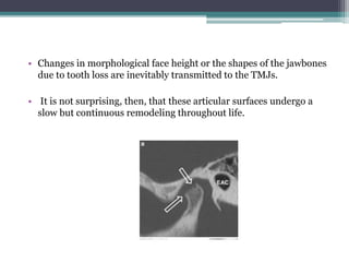 Biomechanics of edentulous state | PPTX